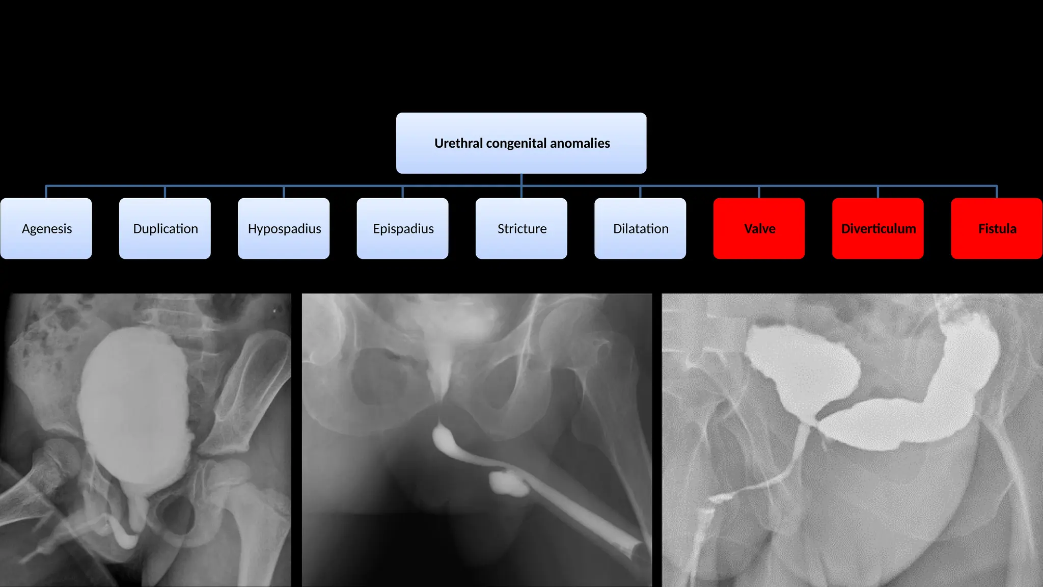 GU radiology part 4 .pptx cases and items | PPT