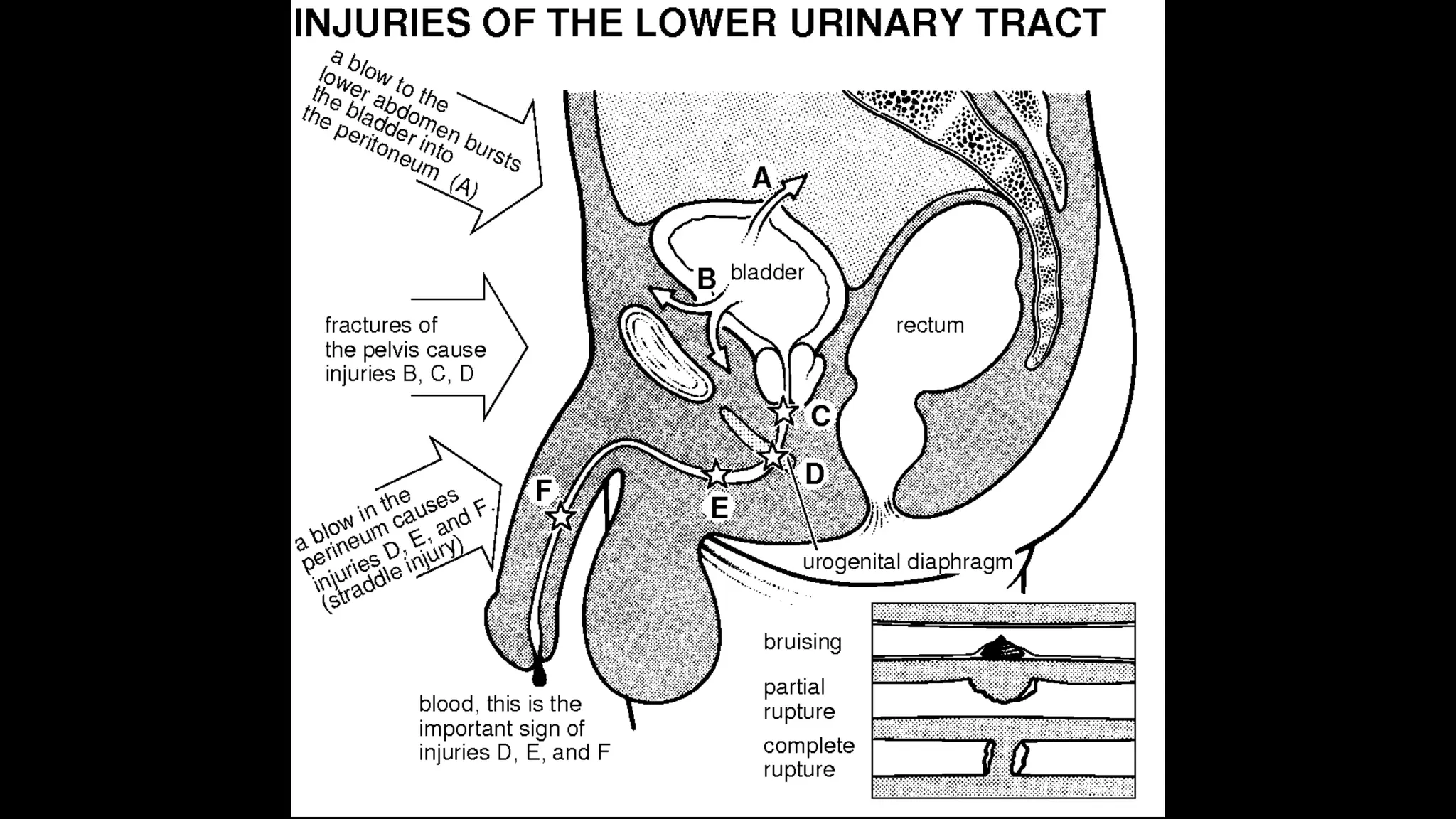 GU radiology part 4 .pptx cases and items | PPT