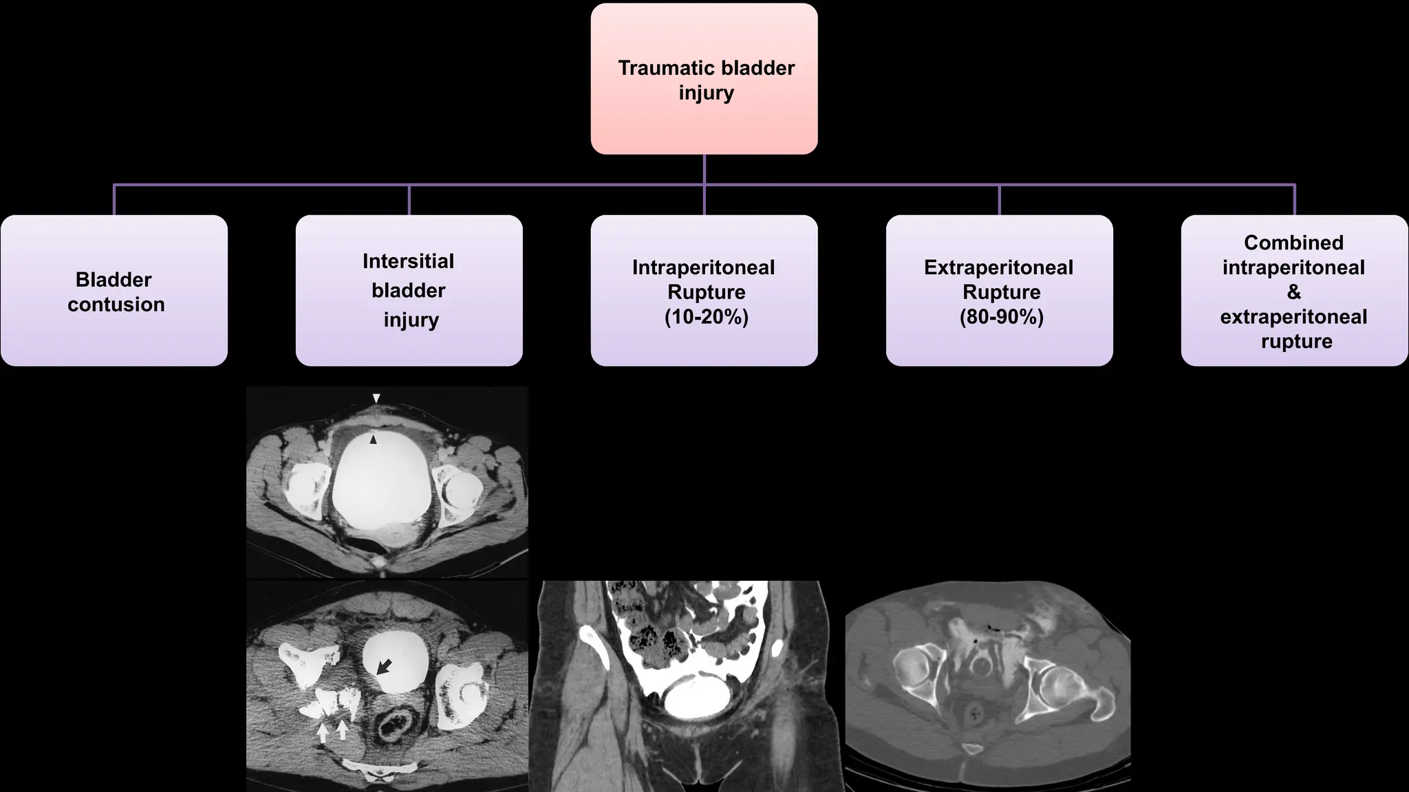 GU radiology part 4 .pptx cases and items | PPT