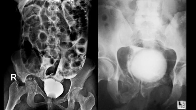 GU radiology part 4 .pptx cases and items | PPT