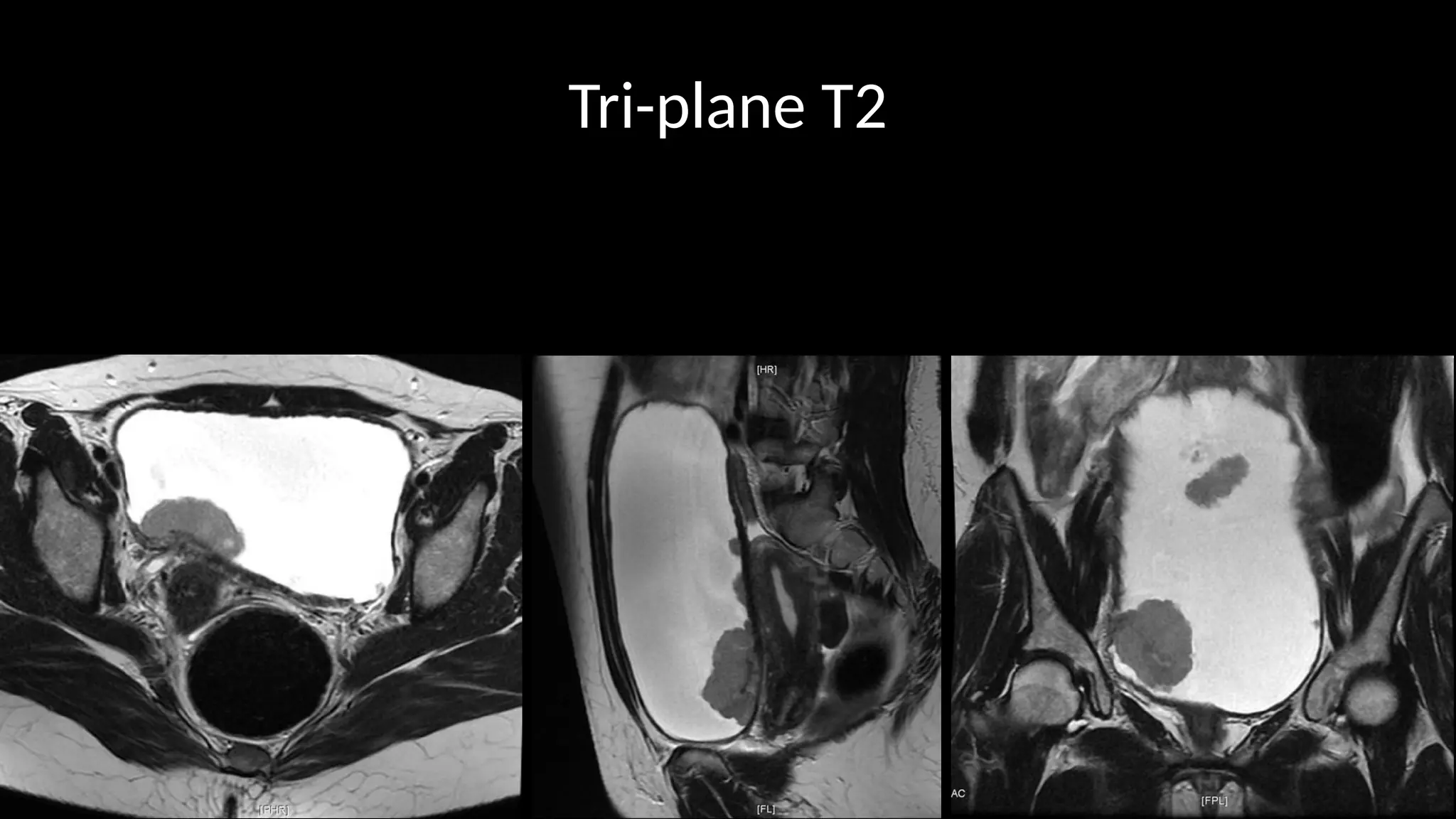 GU radiology part 5 .pptx cases and items | PPTX