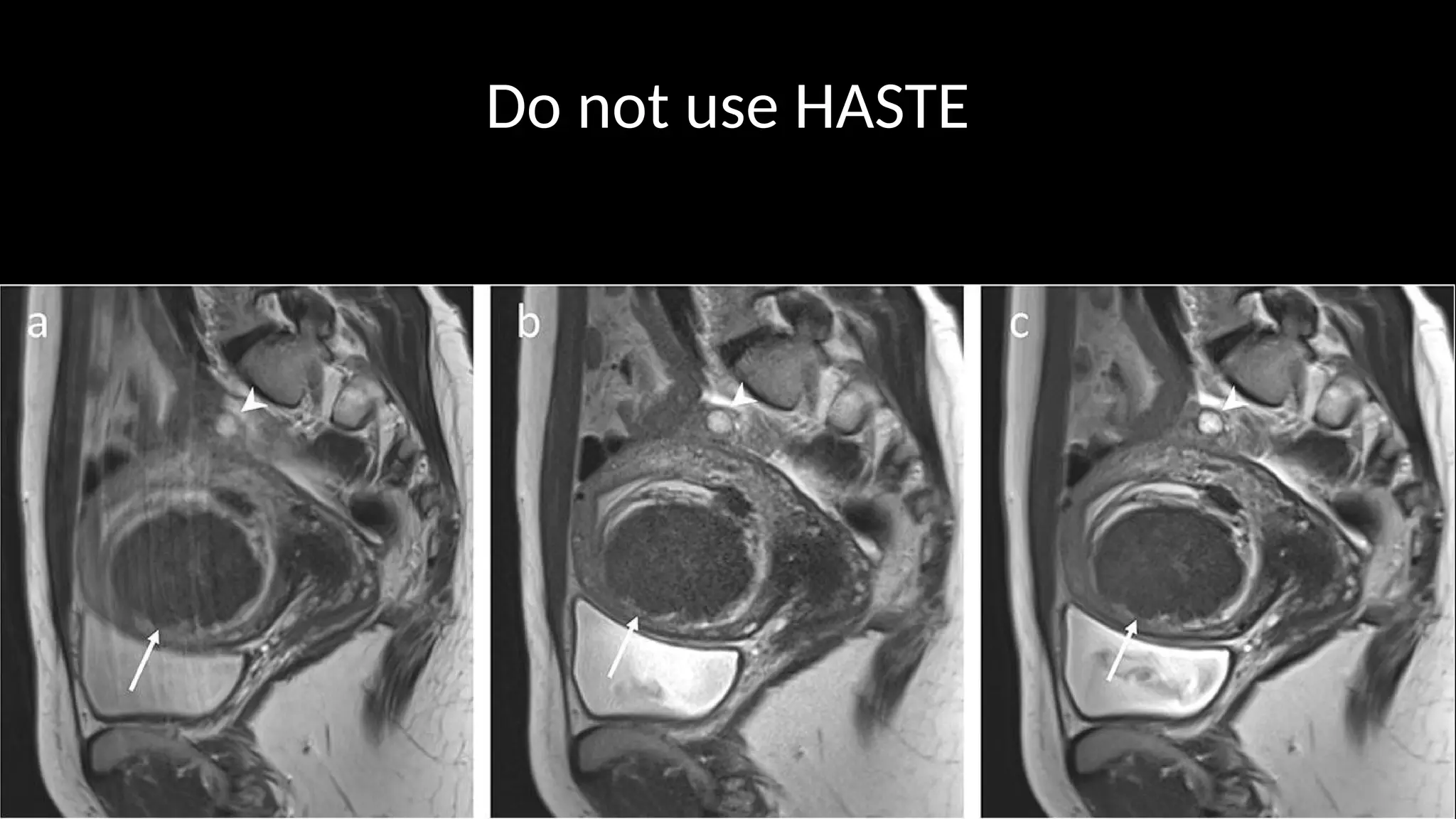 GU radiology part 5 .pptx cases and items | PPT
