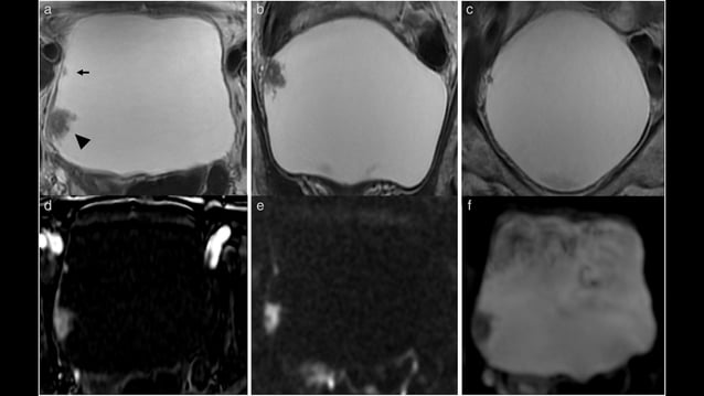 GU radiology part 5 .pptx cases and items | PPT
