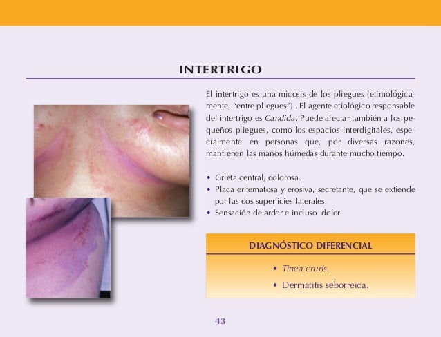 Guía de dermatología