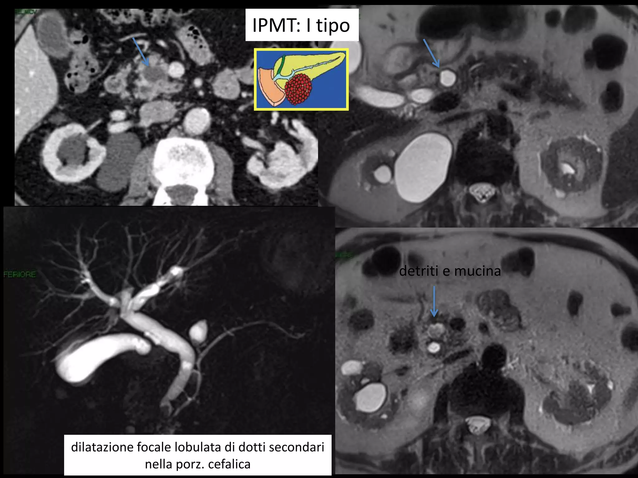Gualdi G. Enterografia/Colangiografia RM. ASMaD 2016 | PPTX | Digestive ...