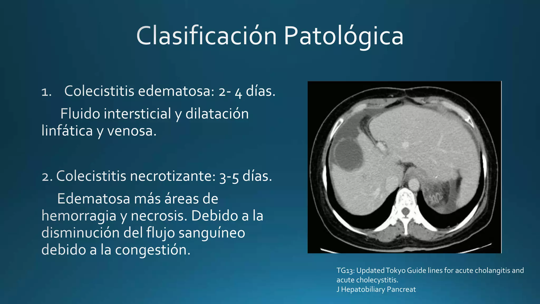 Guías de tokio para colecistitis y colangitis | PPTX | Digestive ...