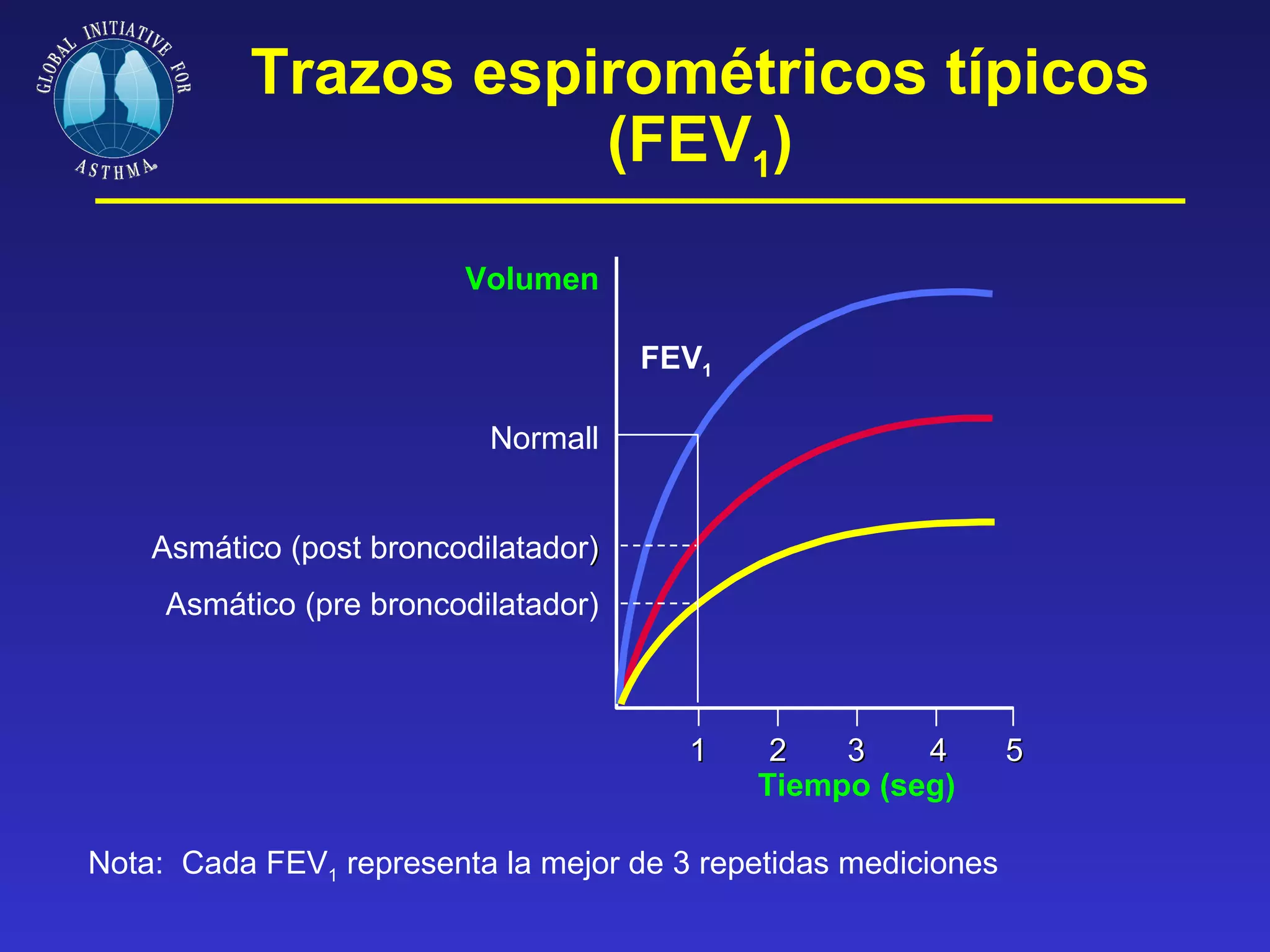 Guías manejo y prevencion del asma lobitoferoz13 | PPT