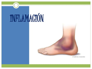 Inflamación.ppt