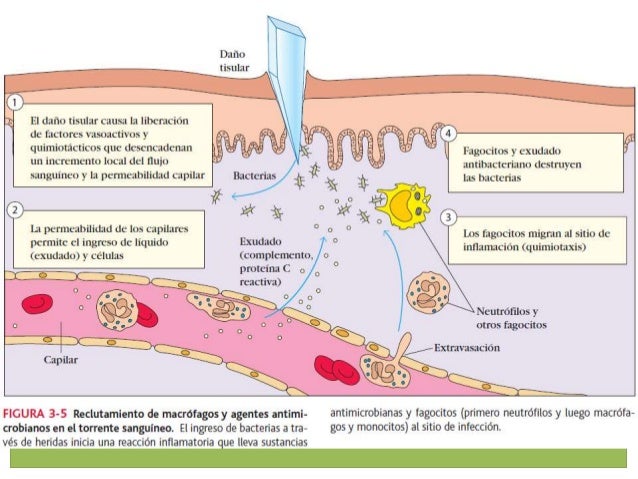 Inflamación.ppt
