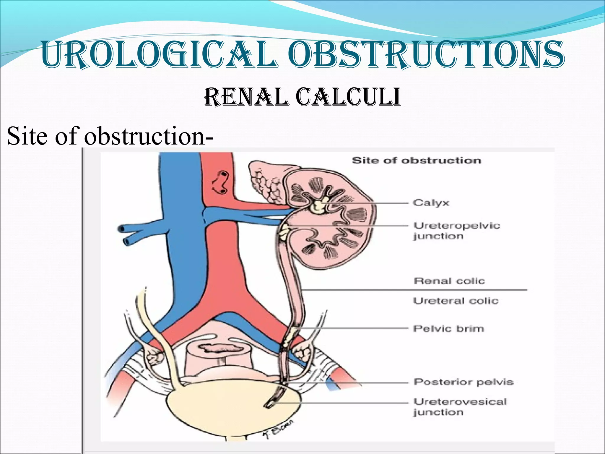 genitourinary disorders (medical surgical nursing) | PPT