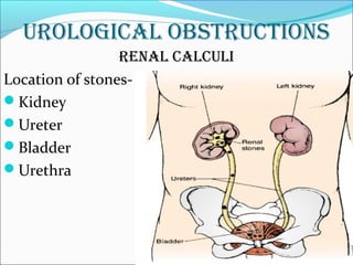 genitourinary disorders (medical surgical nursing) | PPT