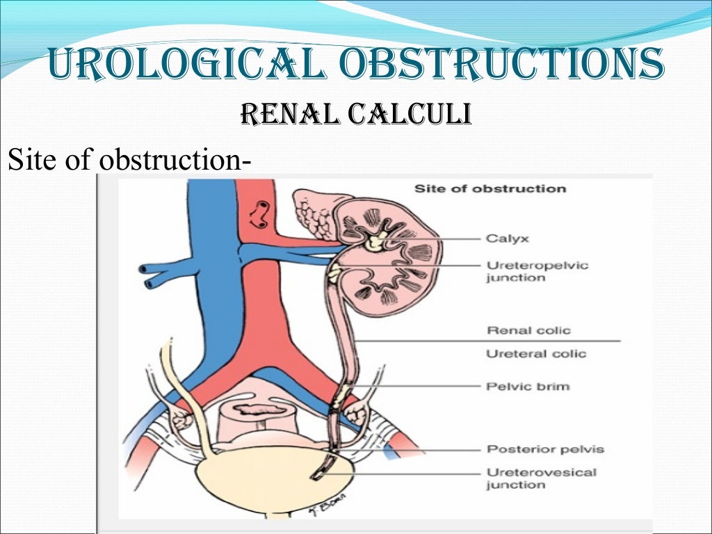 genitourinary disorders (medical surgical nursing)