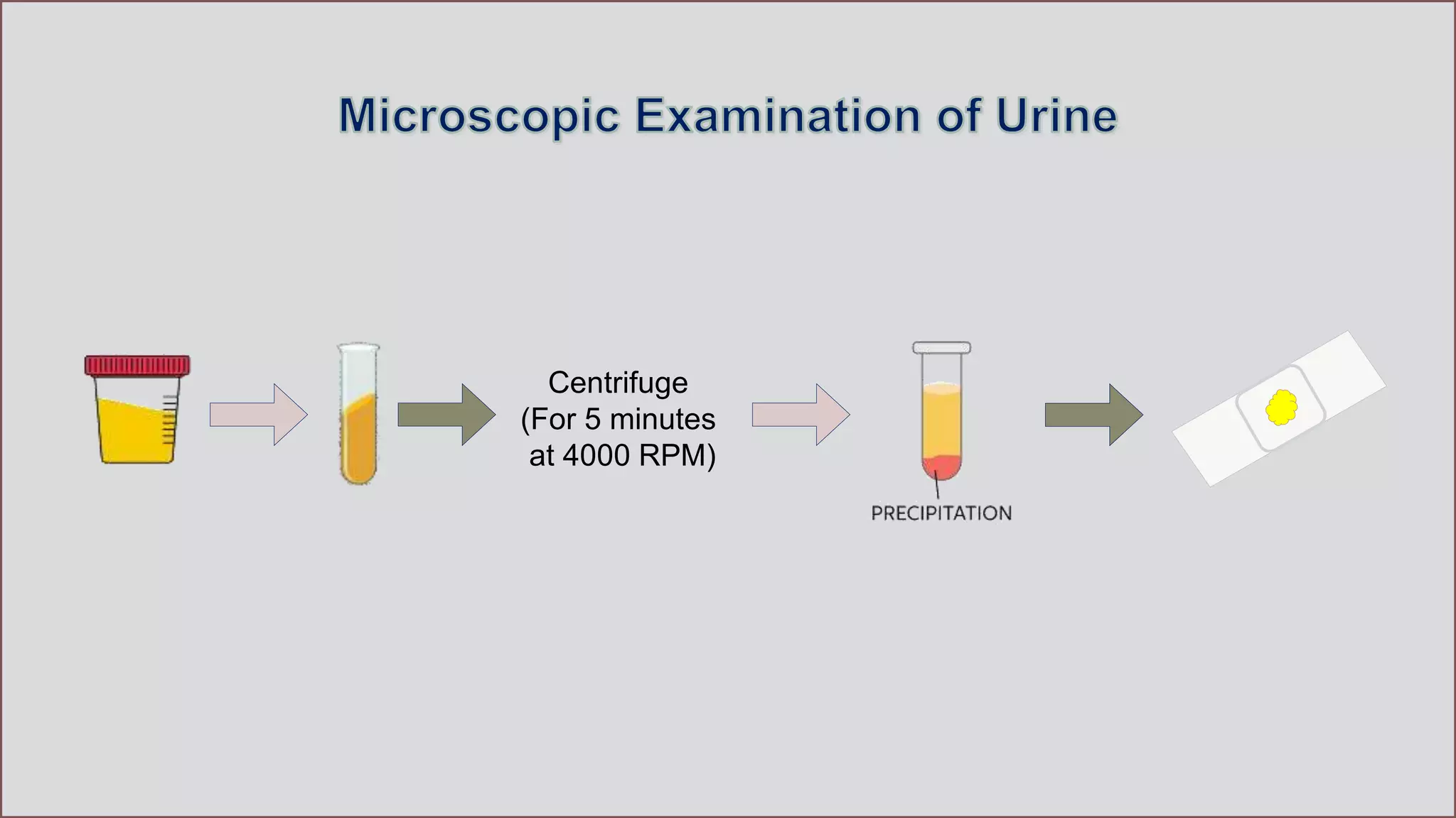 General Urine Examination | PPT