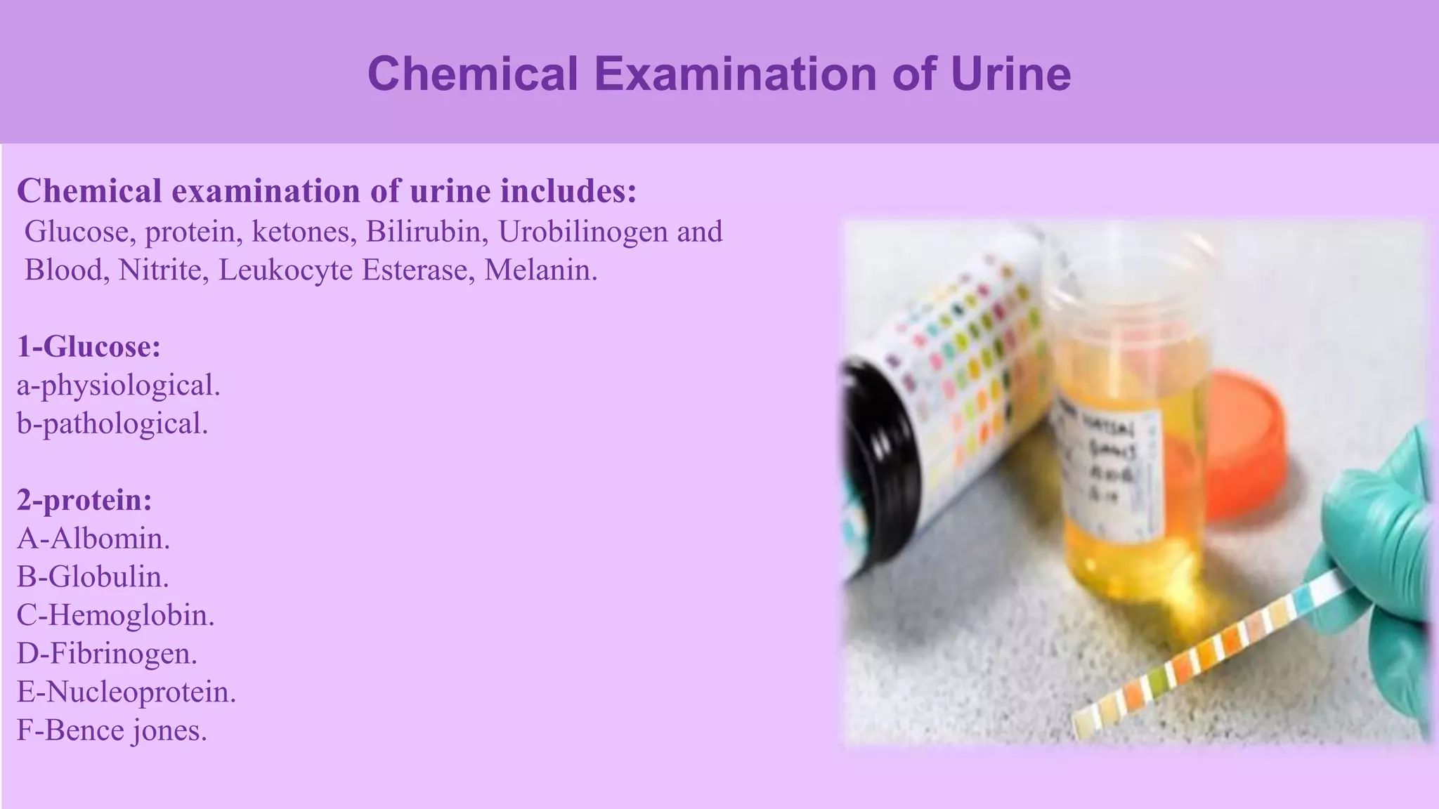 General Urine Examination | PPT