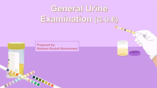 General Urine Examination | PPT