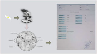 General Urine Examination | PPT