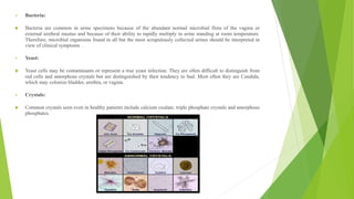 General Urine Examination (GUE) or Urinalysis | PPTX