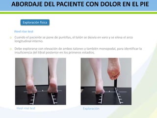Guia abordaje-pie-doloroso-fascitis-plantar | PPTX