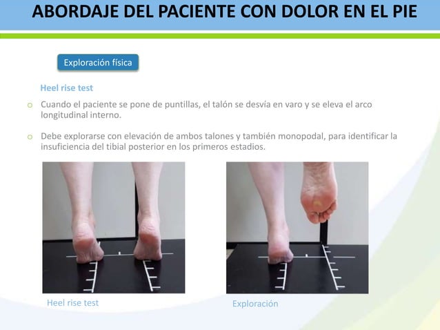 Guia abordaje-pie-doloroso-fascitis-plantar | PPT