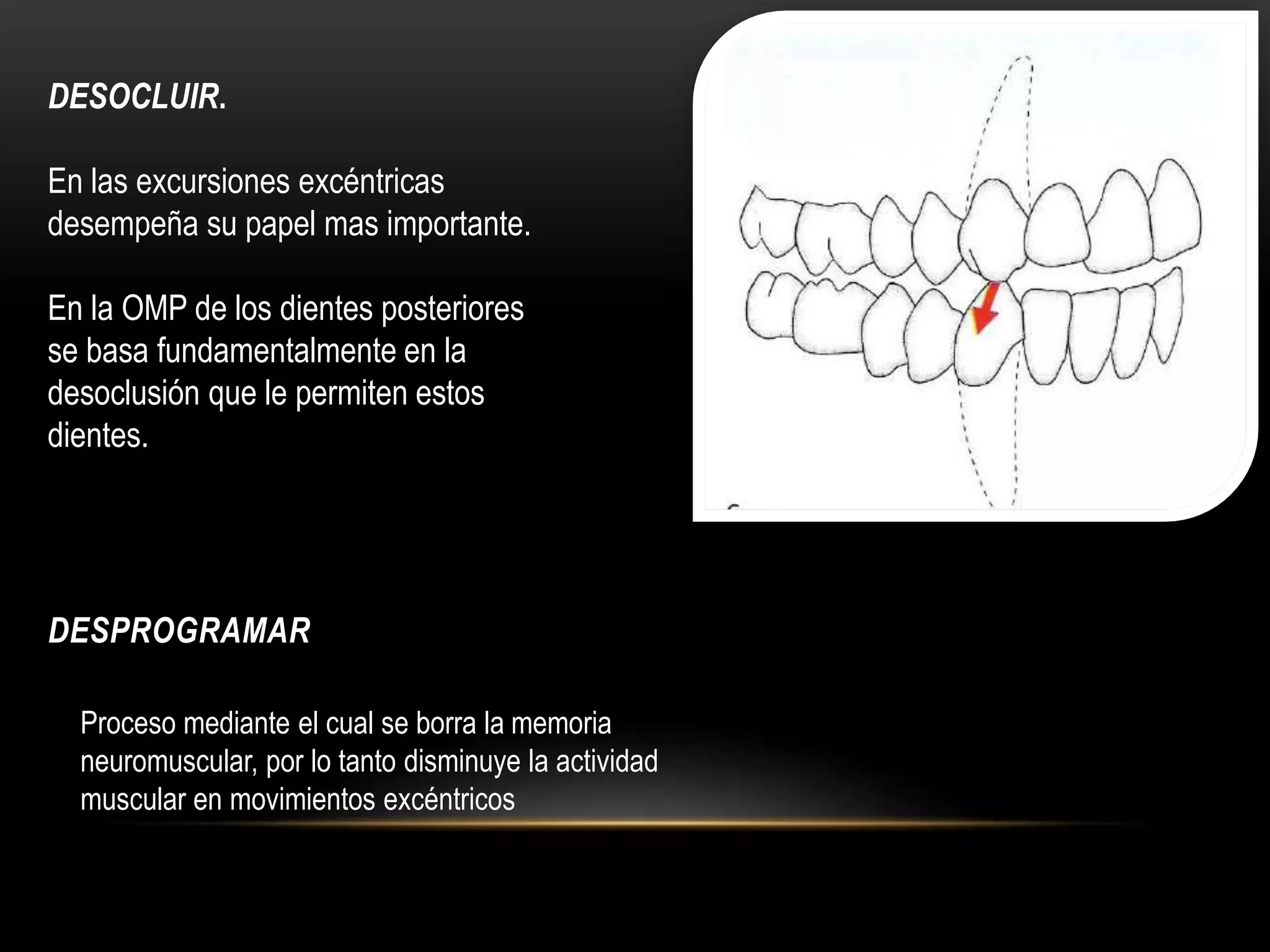 GUIA ANTERIOR OCLUSION