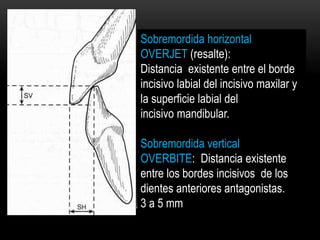 GUIA ANTERIOR OCLUSION | PPT