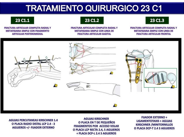 ESSALUD - GUIA CLINICA DE PRACTICA MEDICA DE RADIO DISTAL EN ADULTOS | PPTX