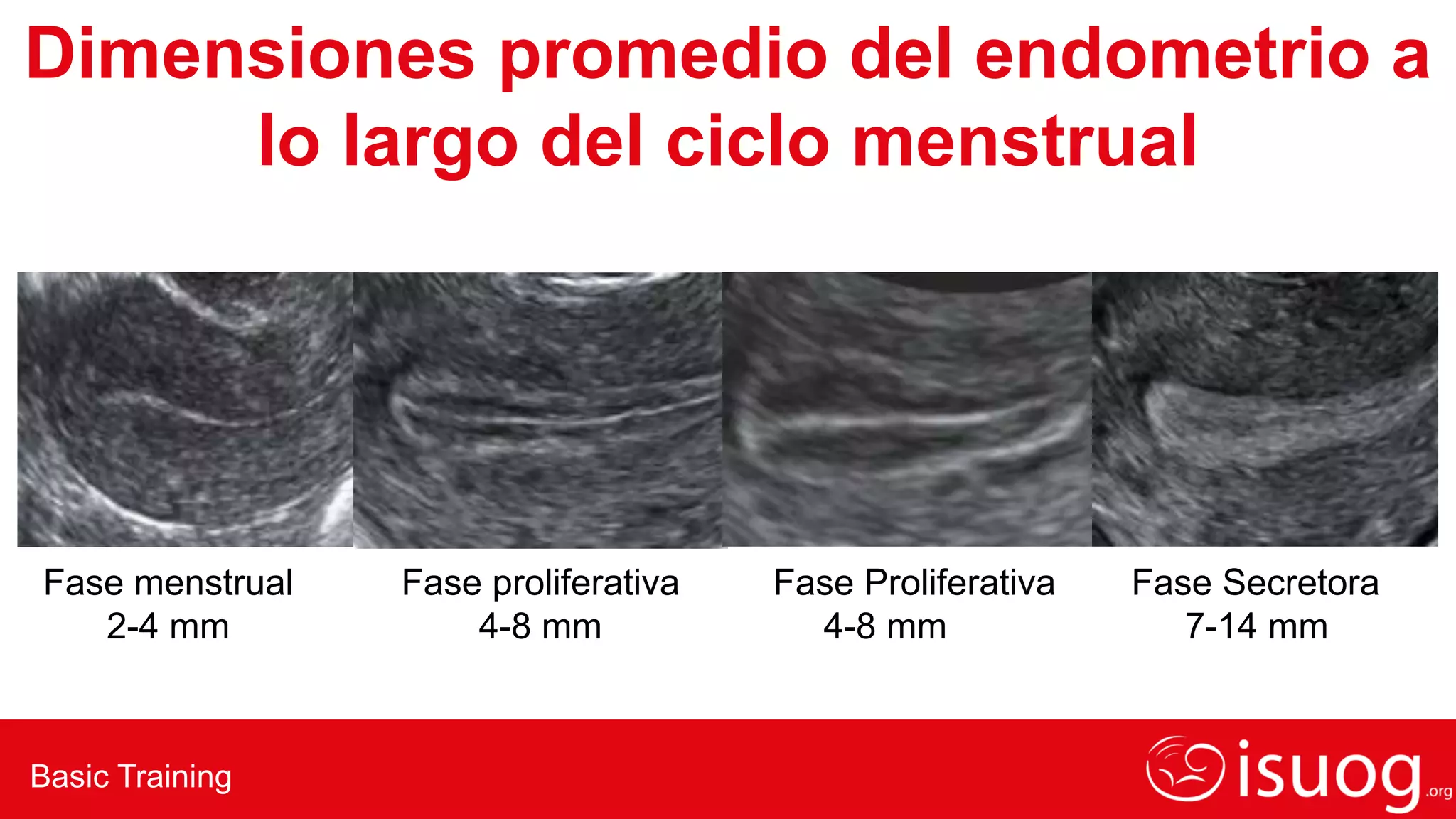 GUIA DE ECOGRAFIA DE utero-cuello-y-endometrio-rev-CV-1019.pdf