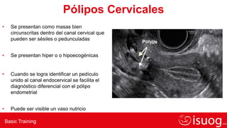 GUIA DE ECOGRAFIA DE utero-cuello-y-endometrio-rev-CV-1019.pdf