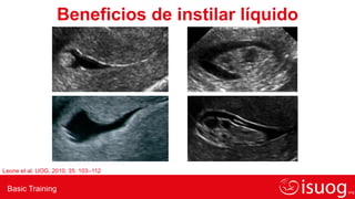 GUIA DE ECOGRAFIA DE utero-cuello-y-endometrio-rev-CV-1019.pdf