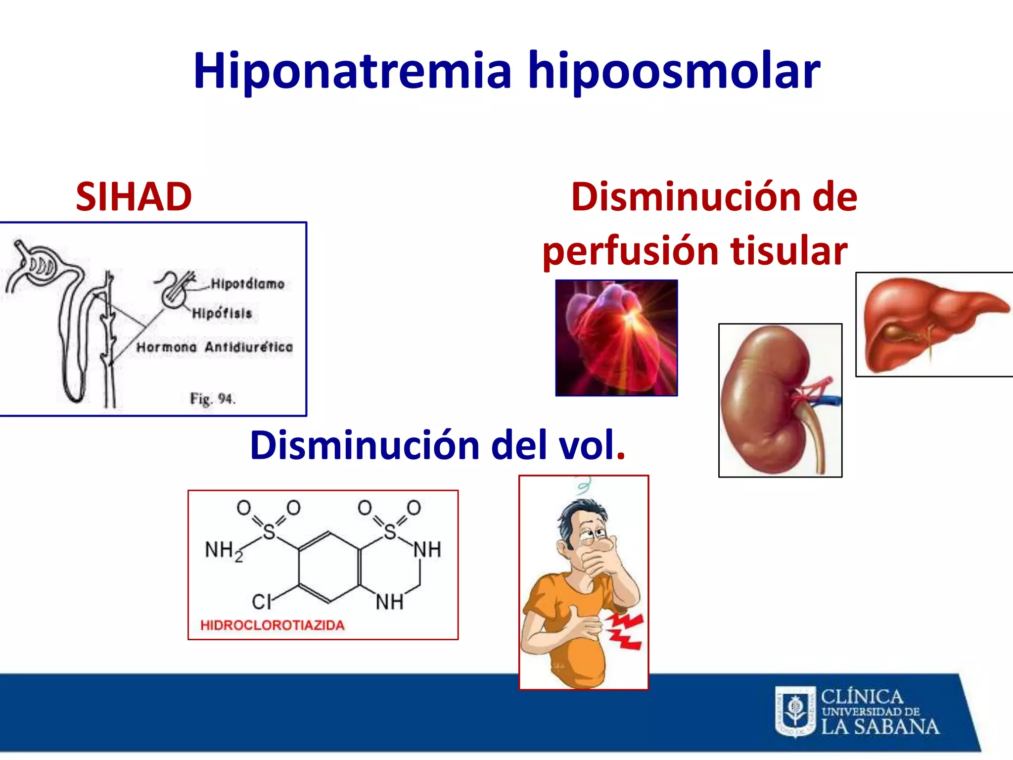 Guia de manejo de hiponatremia. famacologia clinica
