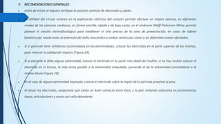 guia ekg.pptx