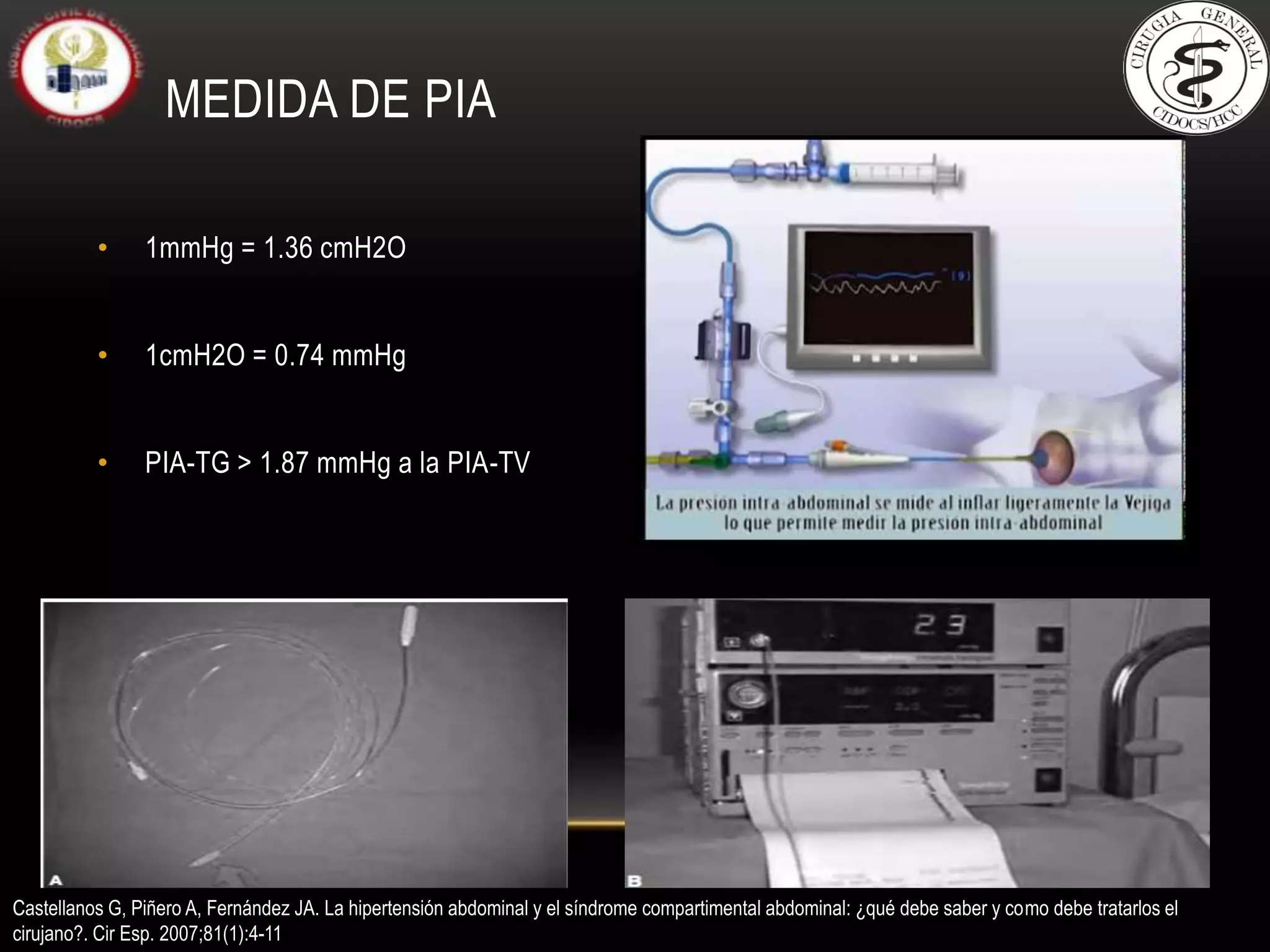 Guia de hipertension intraabdominal y el sindrome compartimentale ...