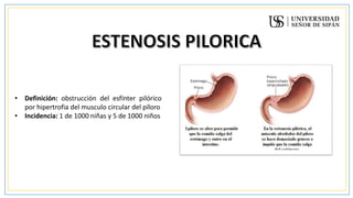 CUIDADOS DE ENFERMERIA AL RECIEN NACIDO CON MALFORMACIONES DIGESTIVAS Y ...
