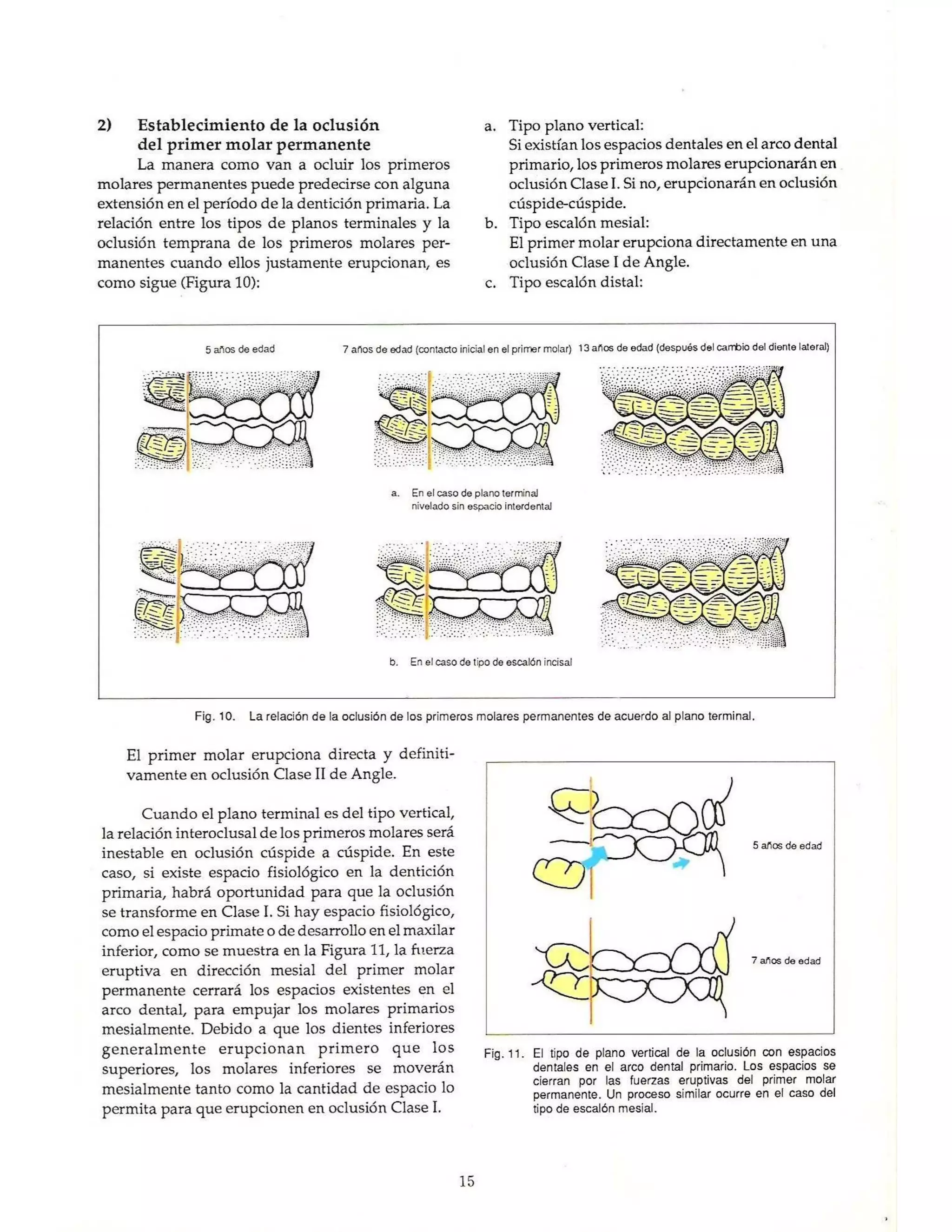 Guia oclusal en odontopediatria | PDF
