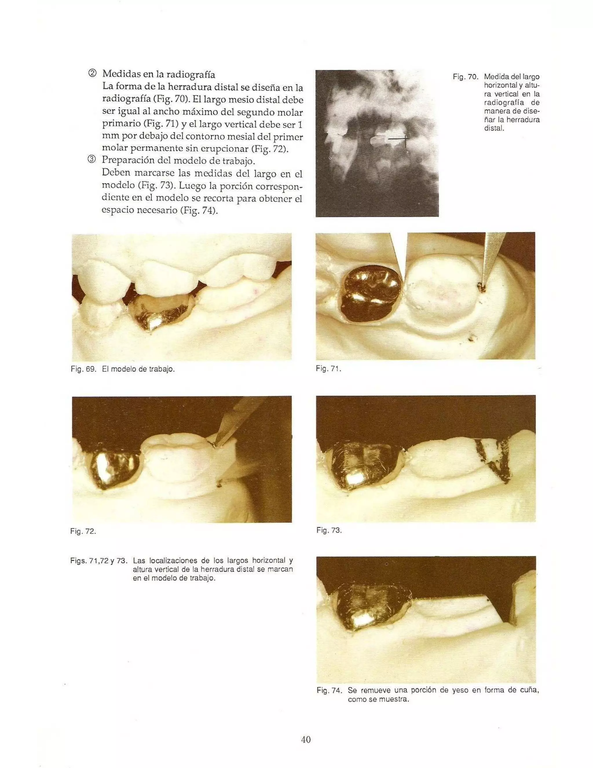 Guia oclusal en odontopediatria | PDF