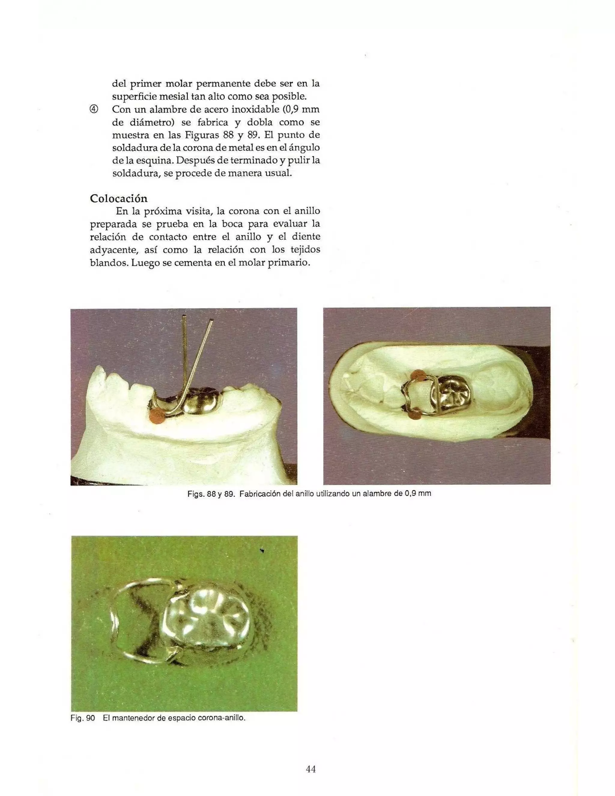 Guia oclusal en odontopediatria | PDF