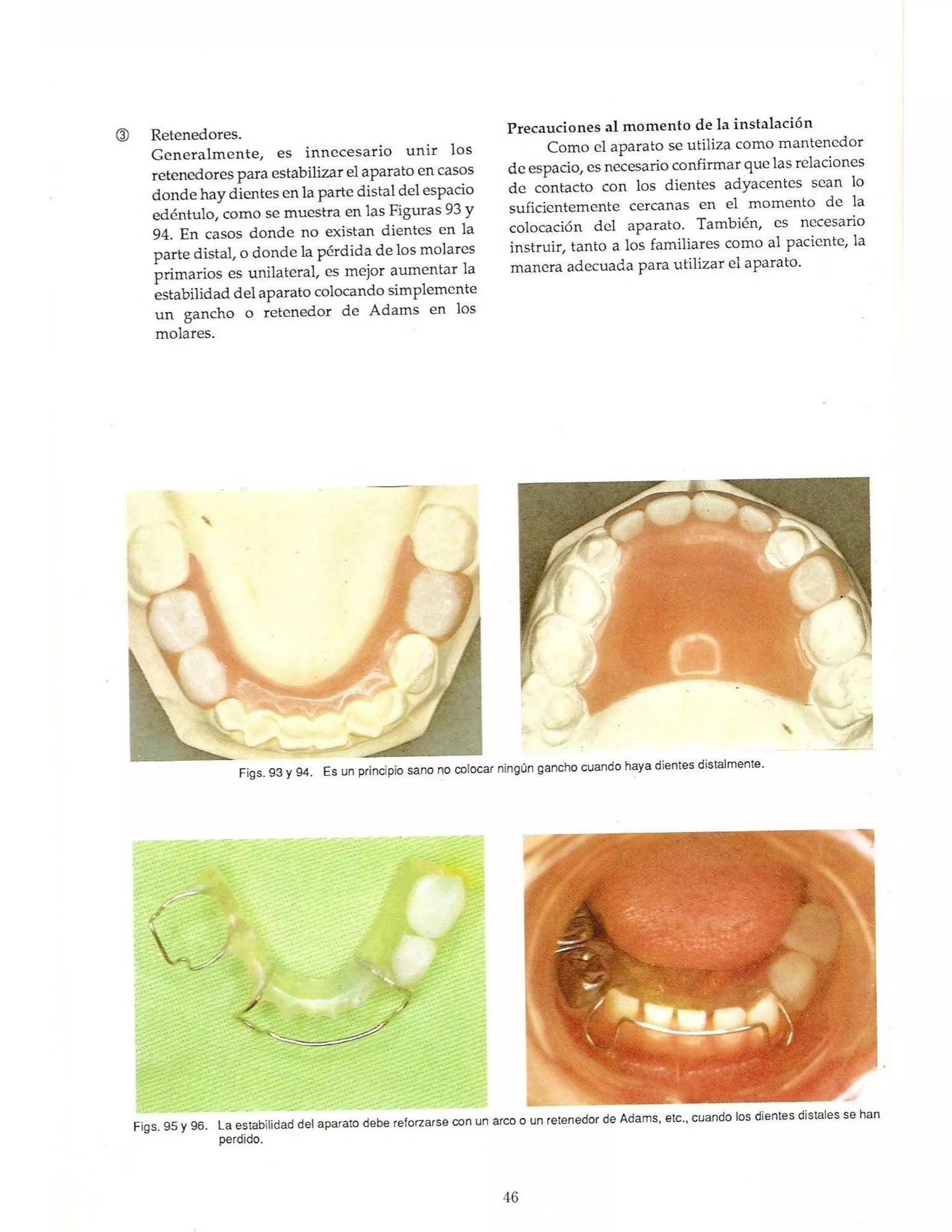 Guia oclusal en odontopediatria | PDF