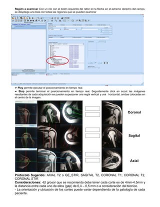 Guía MRI de ESAOTE | PDF