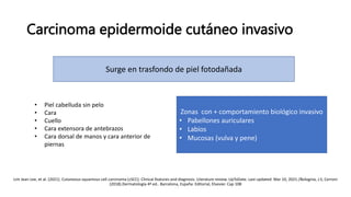 Guias Carcinoma epidermoide cutaneo.pptx