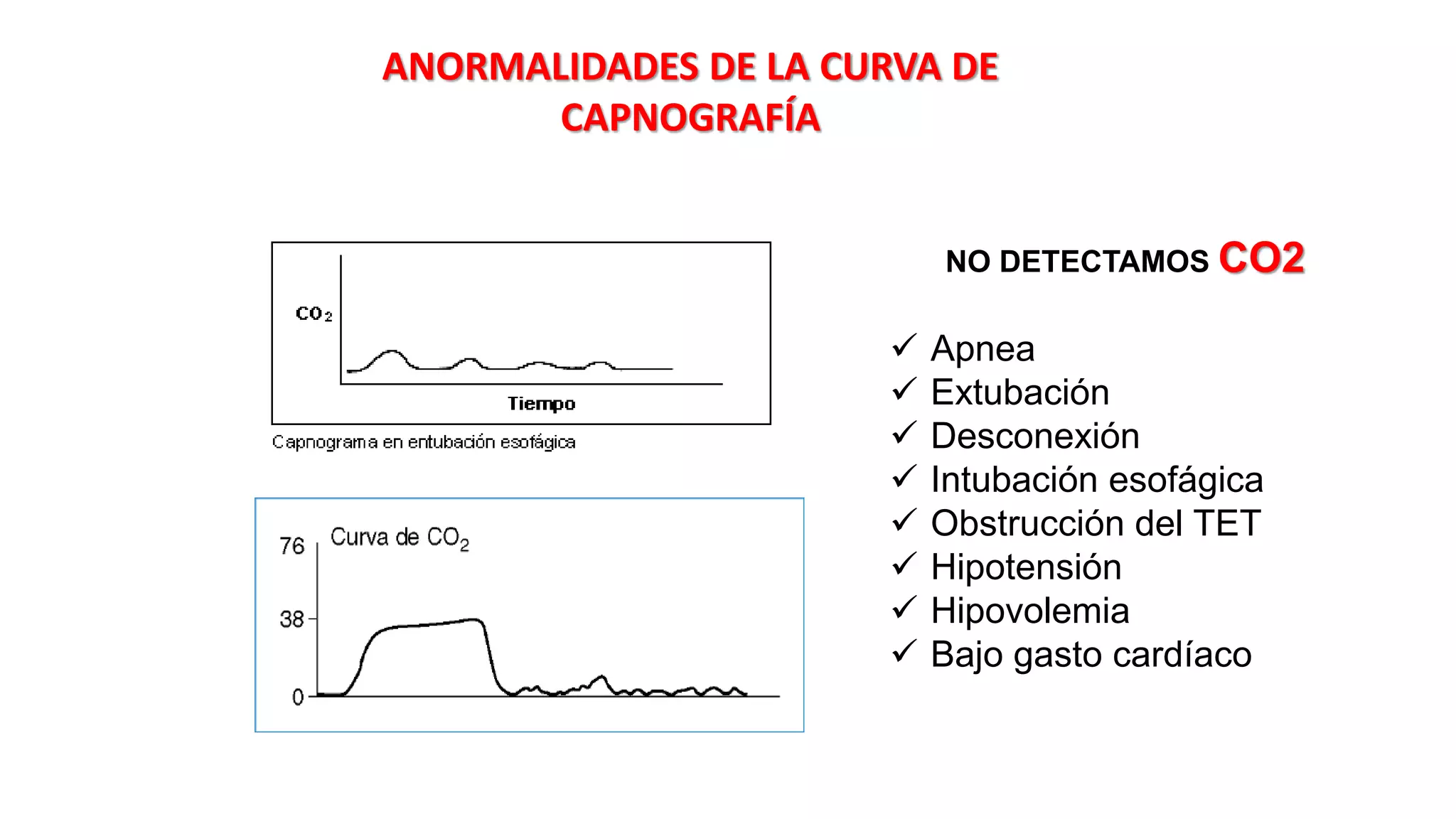 Guias y normas para uso de capnografia en unidad de cuidados intensivos ...