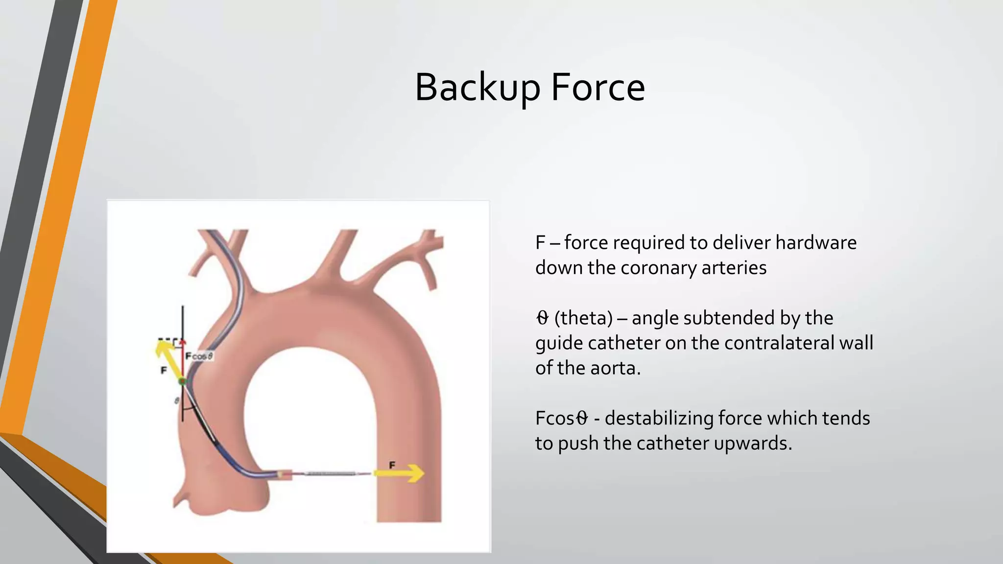 Guide catheters in coronary intervention | PPTX