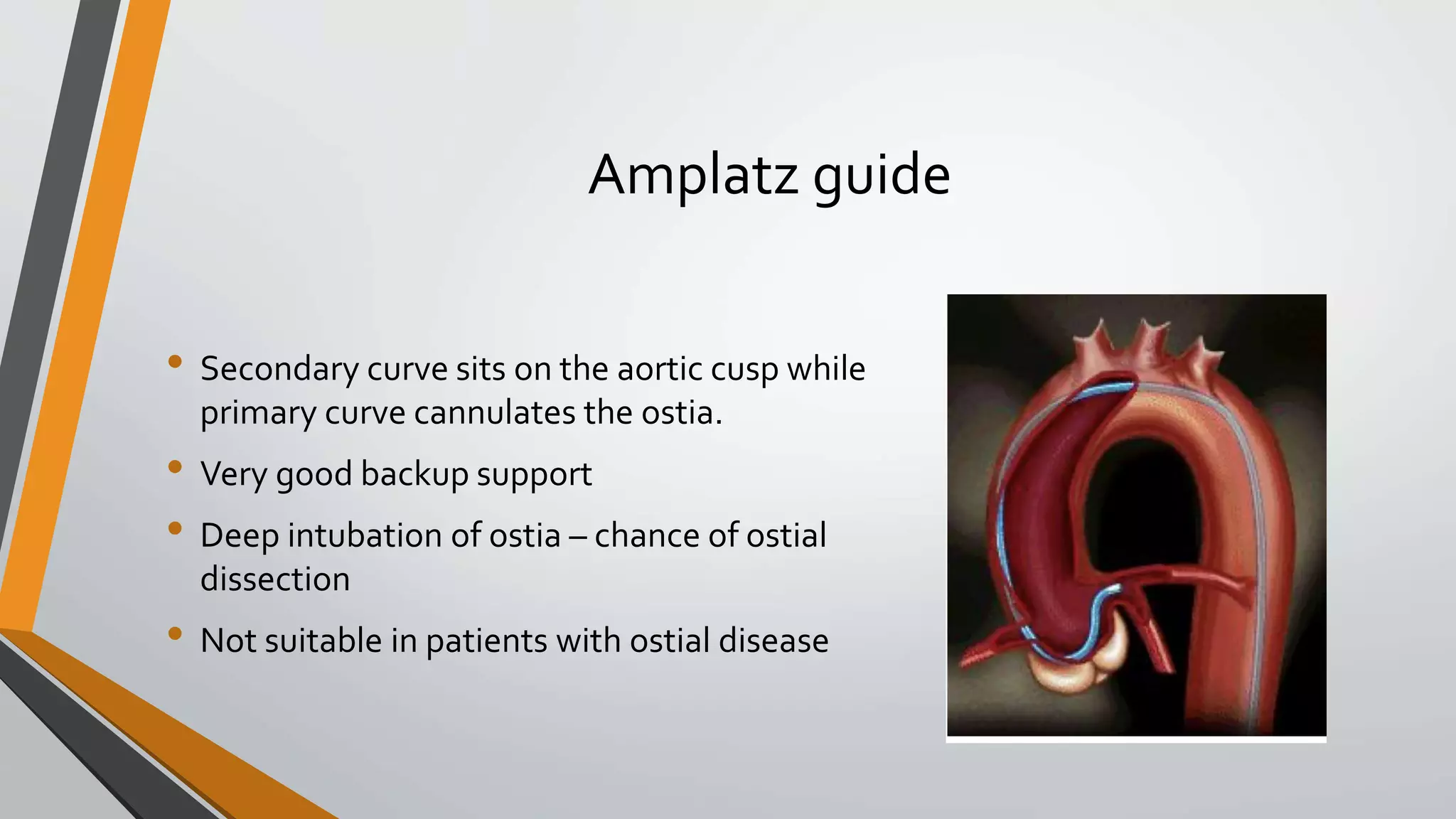 Guide catheters in coronary intervention | PPTX