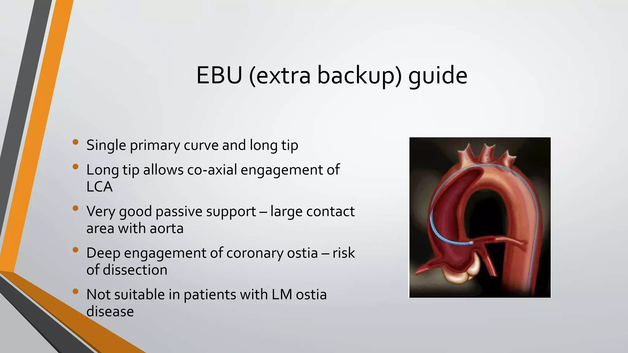 Guide catheters in coronary intervention | PPTX
