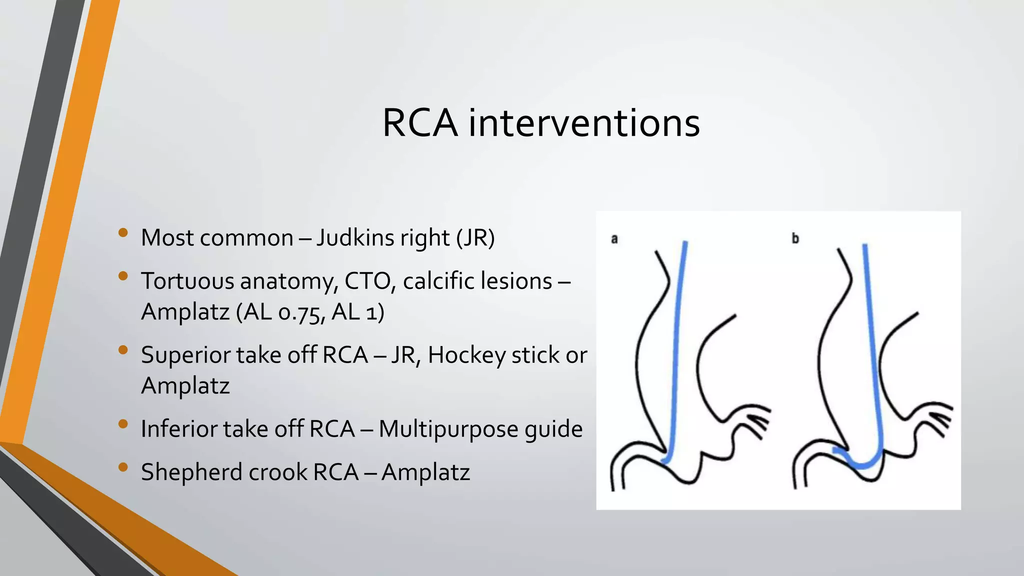 Guide catheters in coronary intervention | PPTX