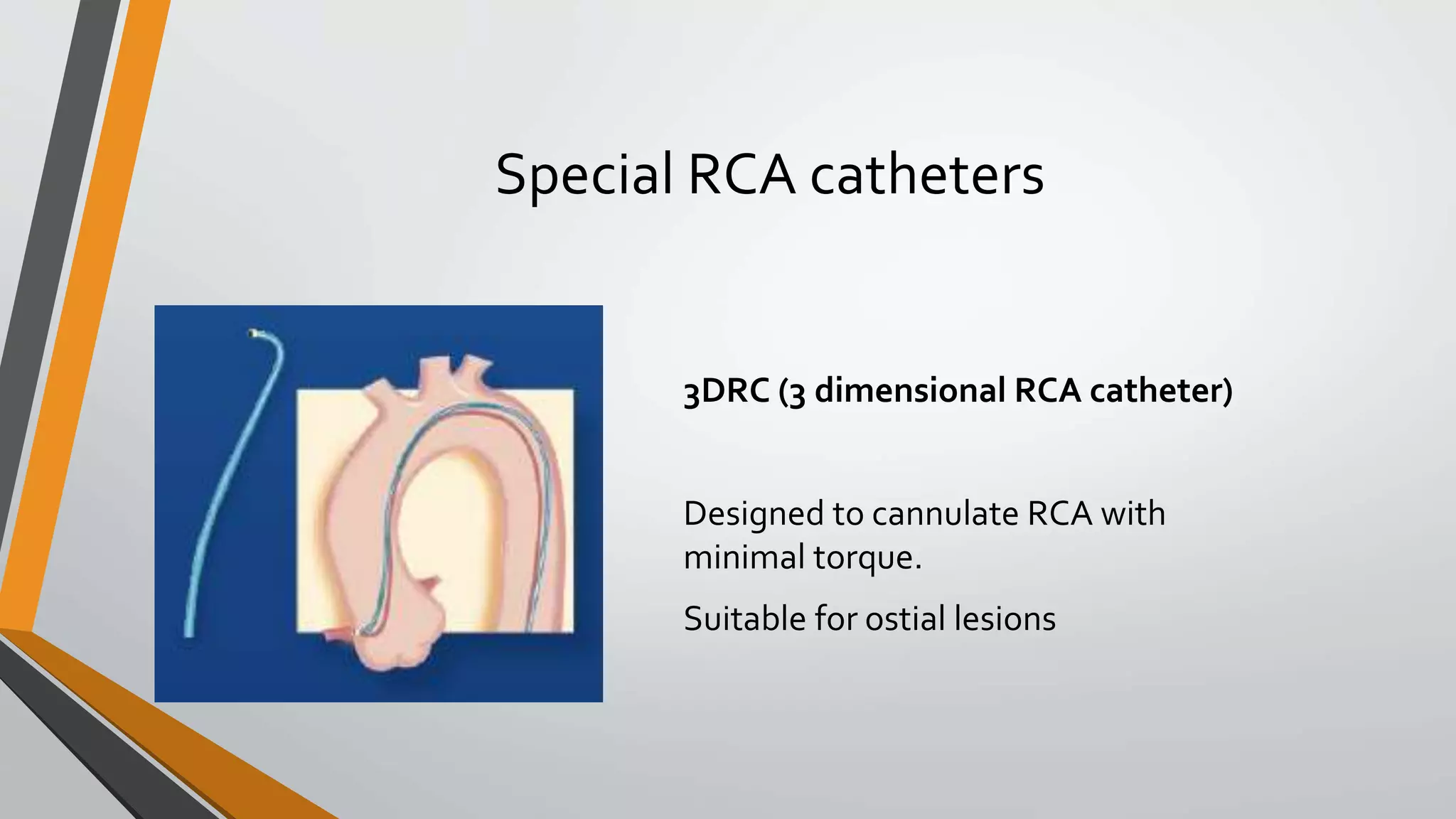 Guide catheters in coronary intervention | PPTX