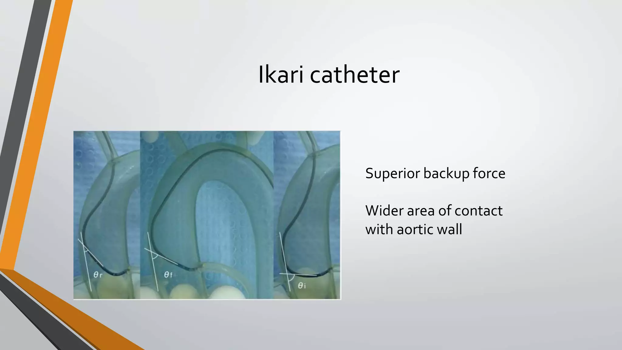 Guide catheters in coronary intervention | PPTX