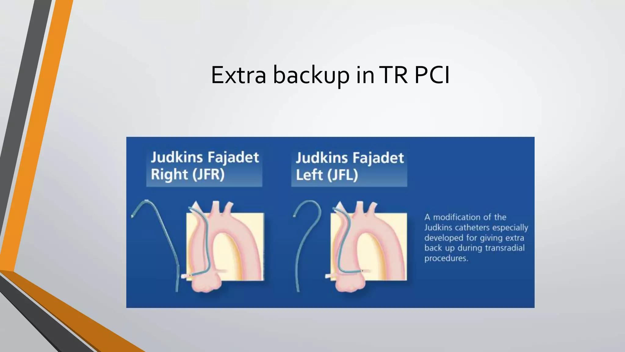 Guide catheters in coronary intervention | PPTX