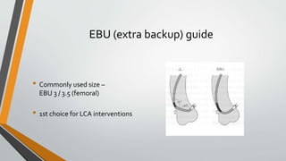 Guide catheters in coronary intervention | PPTX