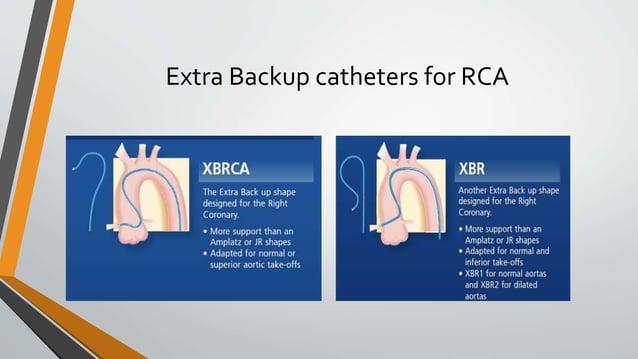 Guide catheters in coronary intervention | PPTX