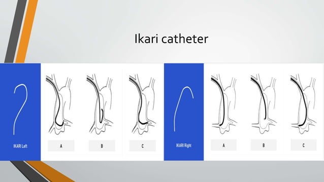 Guide catheters in coronary intervention | PPTX